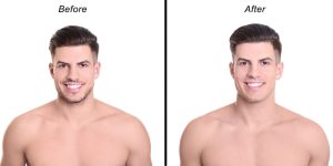 VoltGroom w Polsce - Ekskluzywna zniżka 50%!